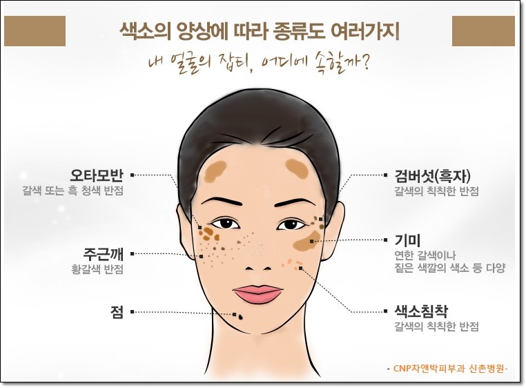 자외선 강해지는 봄철 피부색소문제레블라이트 시술받고 태양의 후예 송혜교 같은 맑고 투명한 피부만들기 네이버 블로그
