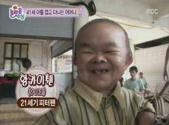 하이랜더 증후군 슬픈병이네요 네이버 블로그